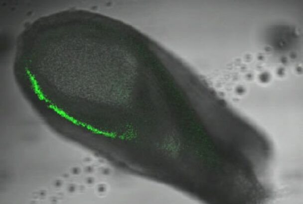 The Reasons Behind the Loss of Human Tails: What Scientists Have ...